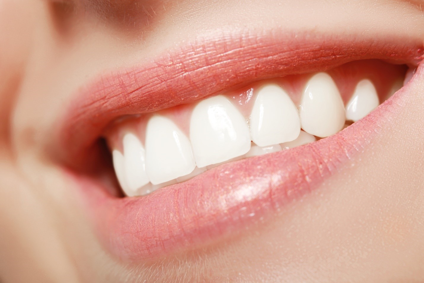 Gummy Smile? Here’s How Your Dentist Can Help